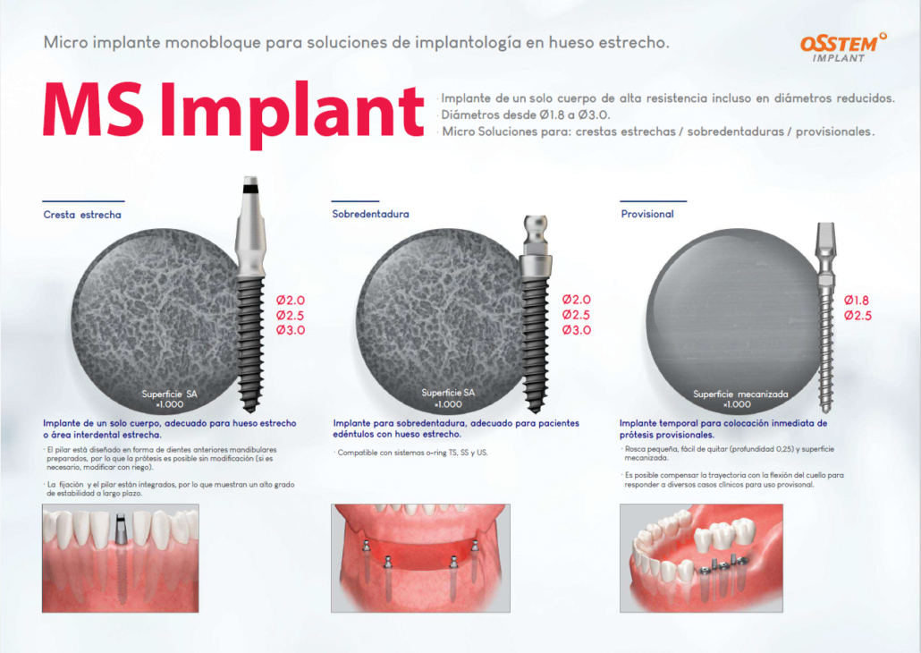 Catálogos – Marketing Osstem Spain