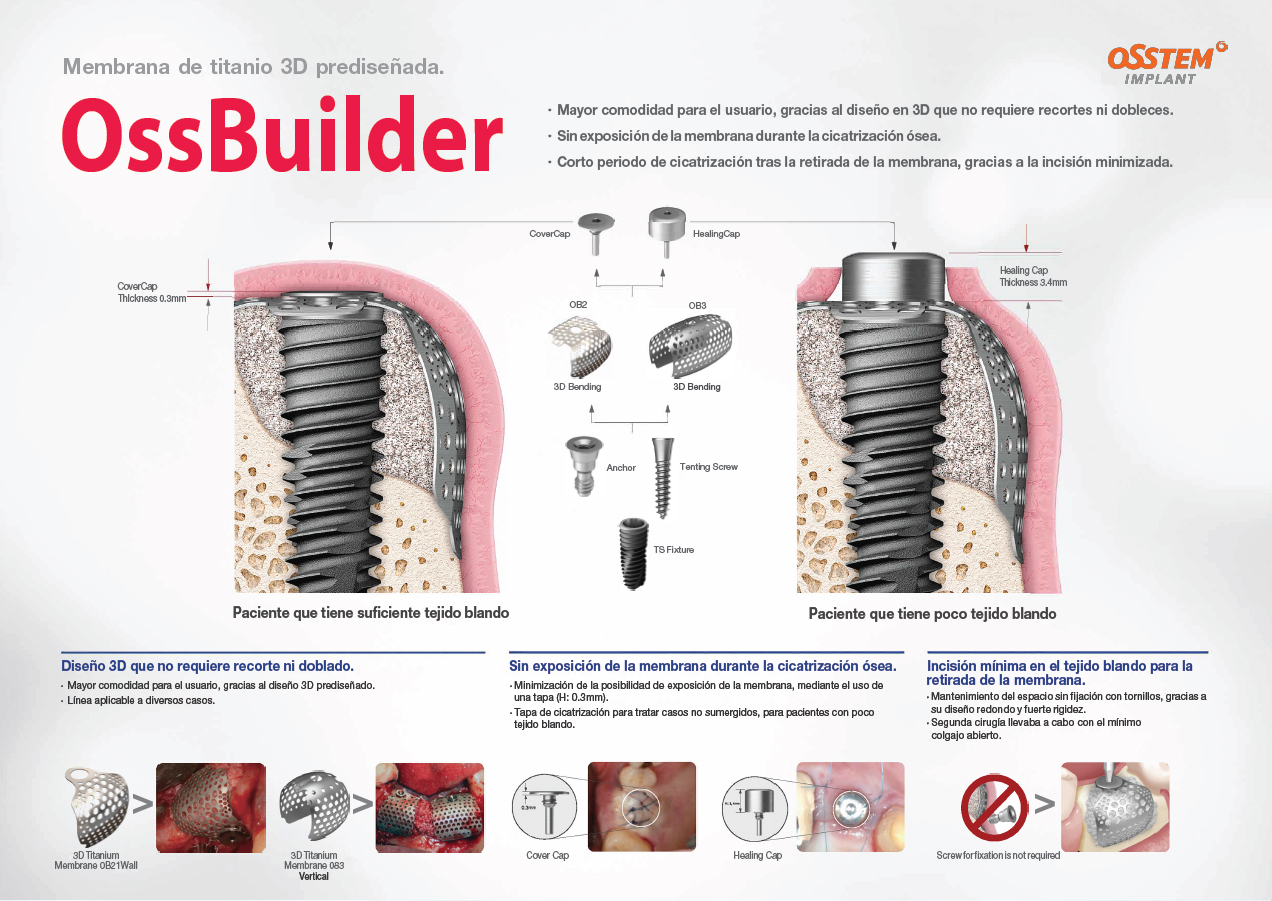 Catálogos – Marketing Osstem Spain